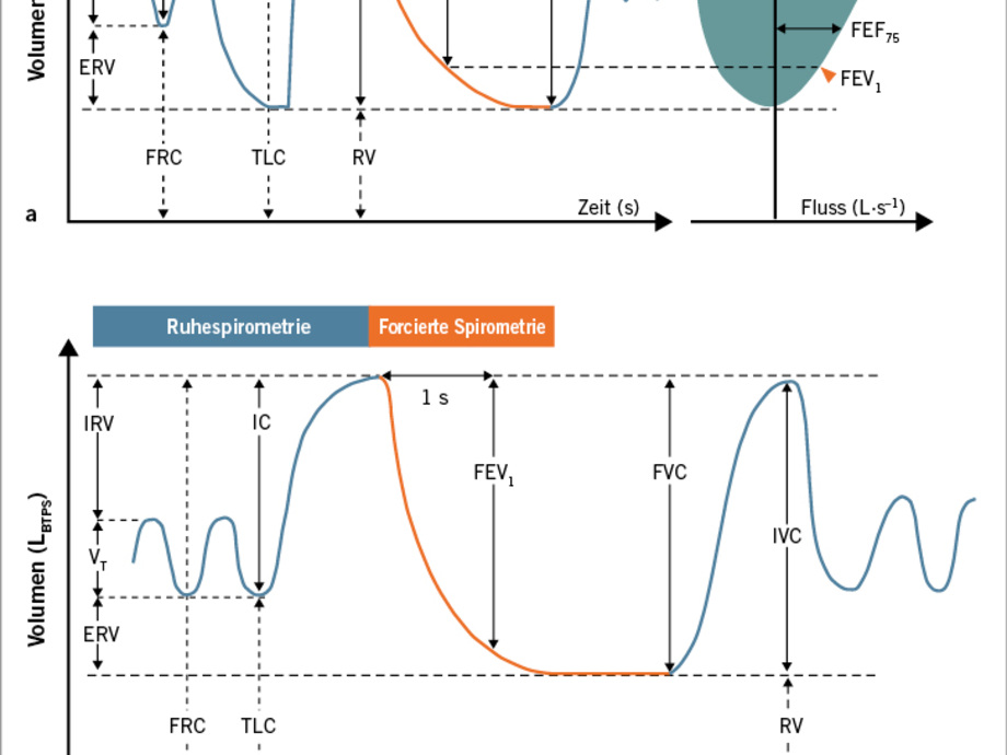 Leitlinie der Deutschen Atemwegsliga, der Deutschen Gesellschaft für ...