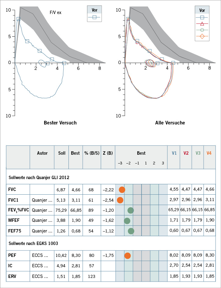 Leitlinie der Deutschen Atemwegsliga, der Deutschen Gesellschaft für ...
